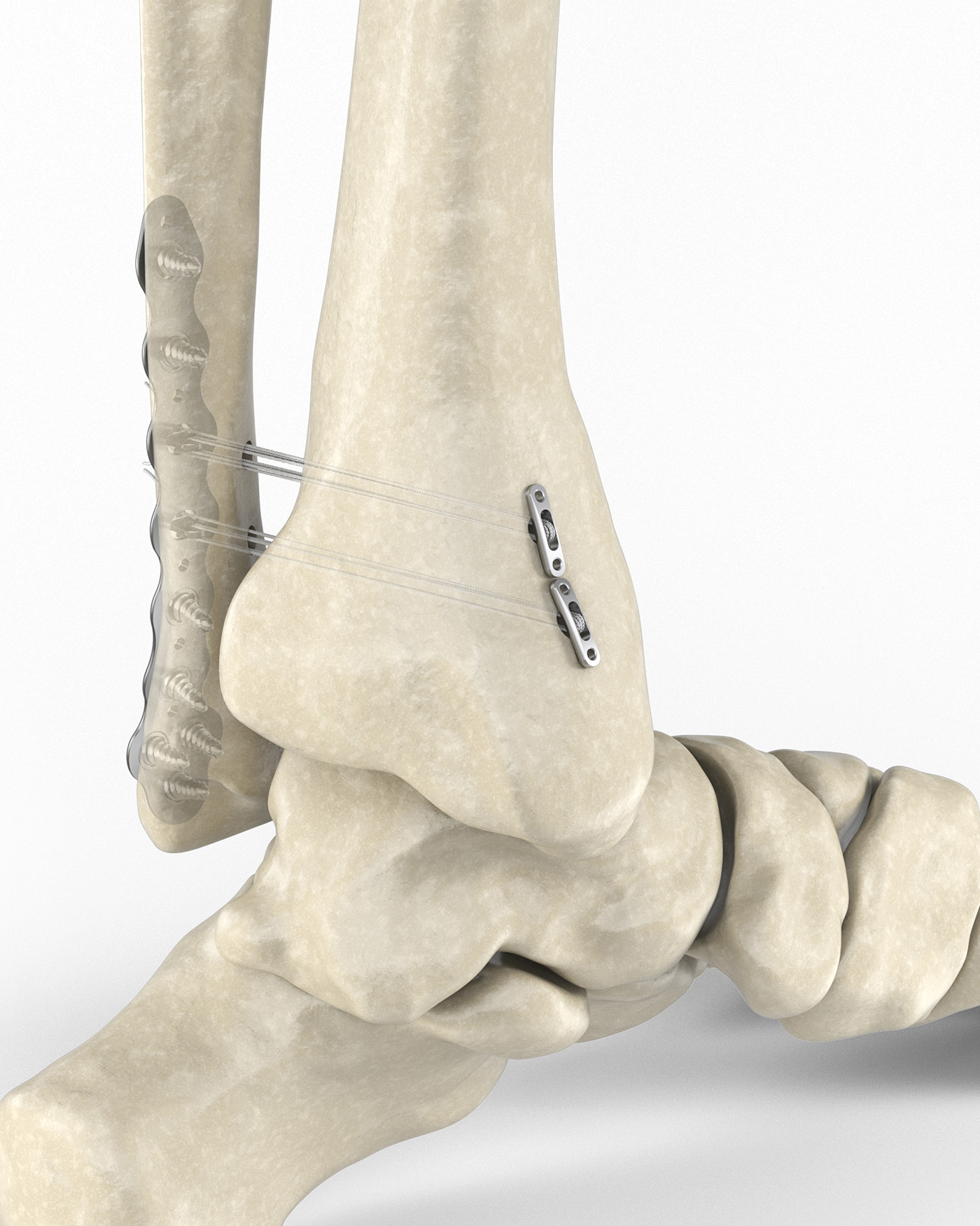 Enofix – ANIMED by aldente