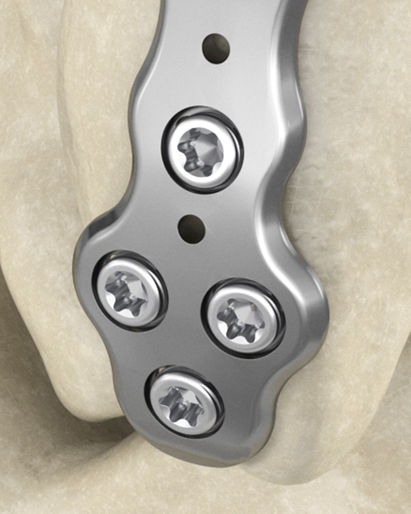 Enofix – ANIMED by aldente