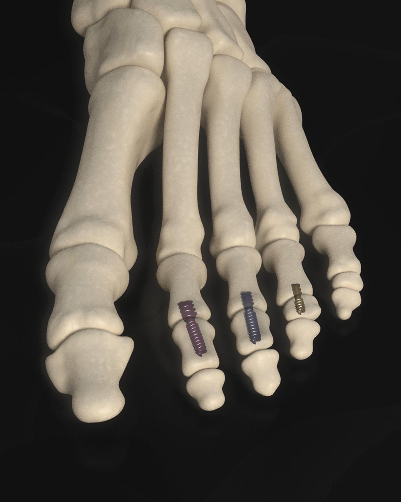 Two step animation – ANIMED by aldente