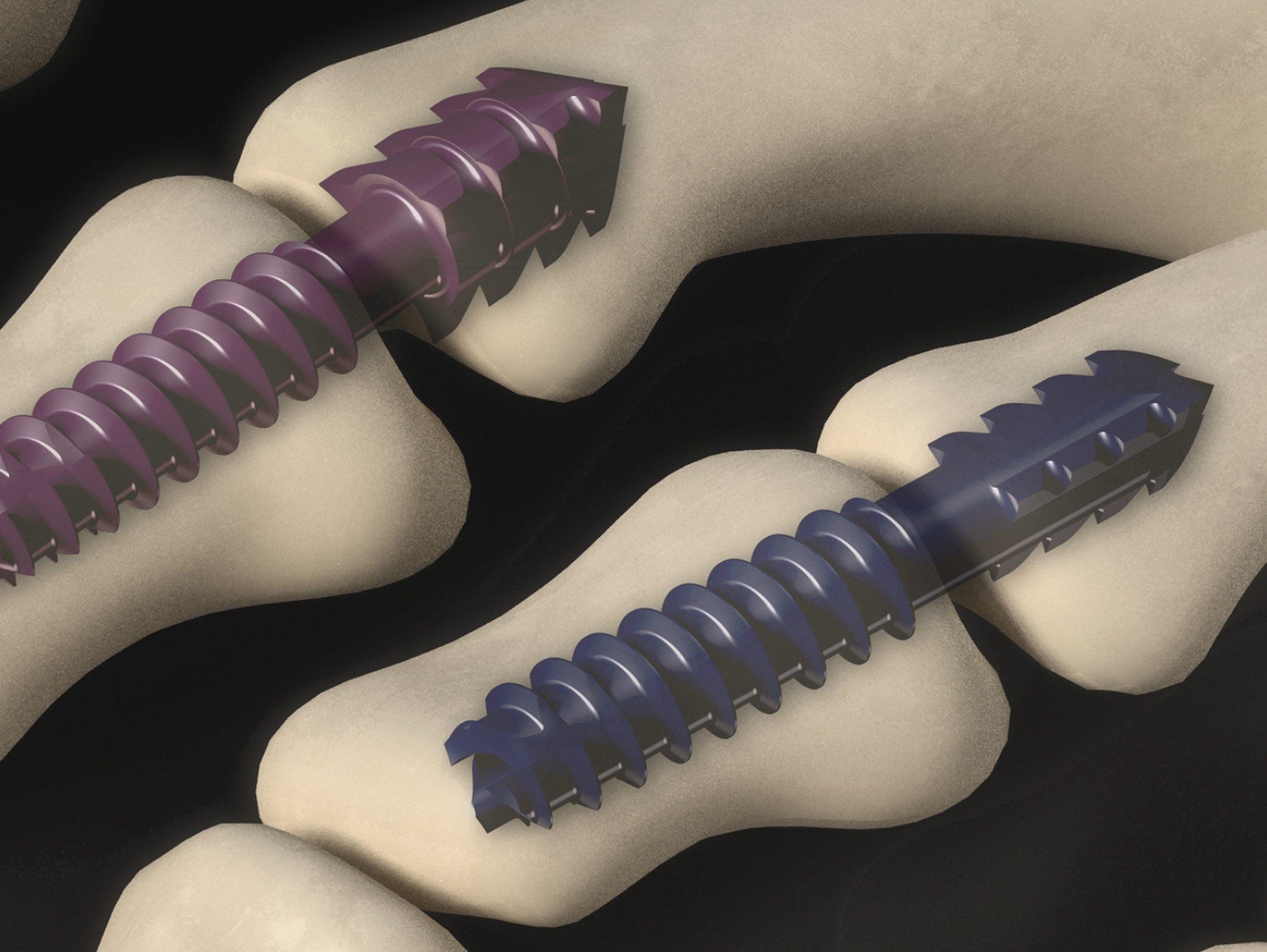 Two step animation – ANIMED by aldente